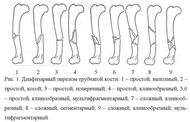 foto-osteosinteza-3 - СВЕТИ ВРАЧИ